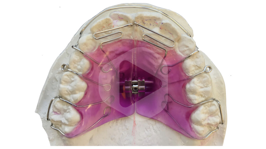 Ortodontia e Ortopedia na infância - Orthopedlearning